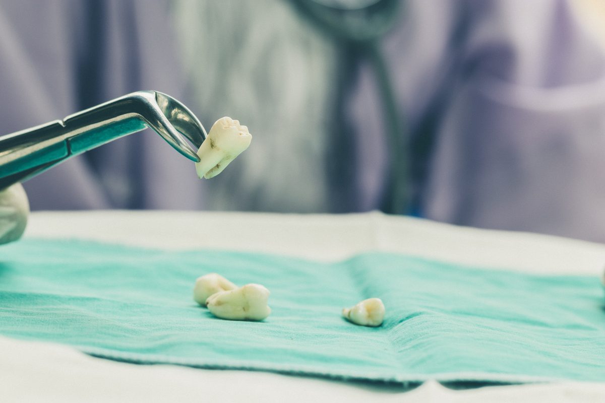 How Extracting A Tooth Could Benefit Smiles | Houston, TX