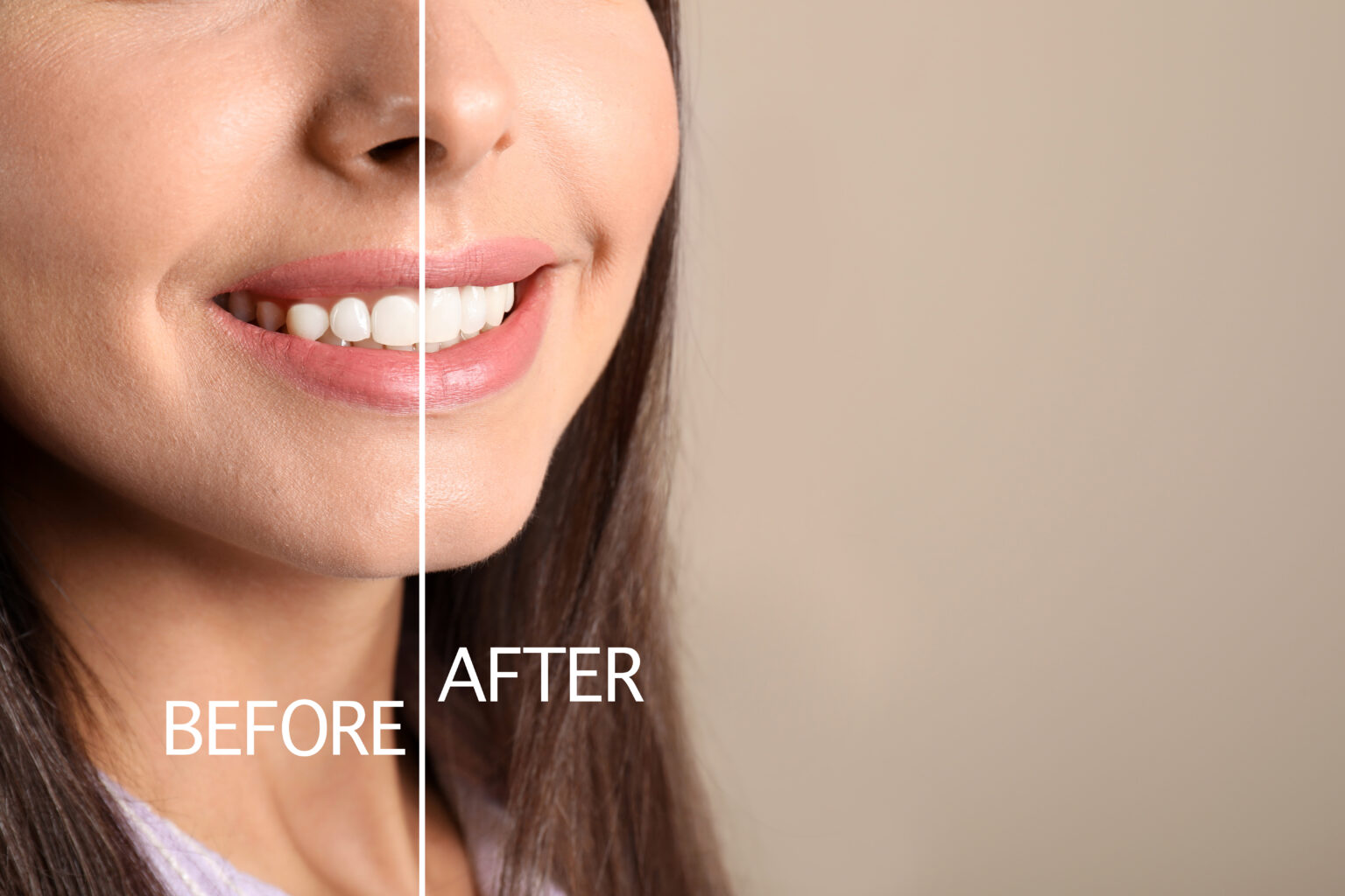 Improve Your Gum Line With Laser Contouring | Houston, TX